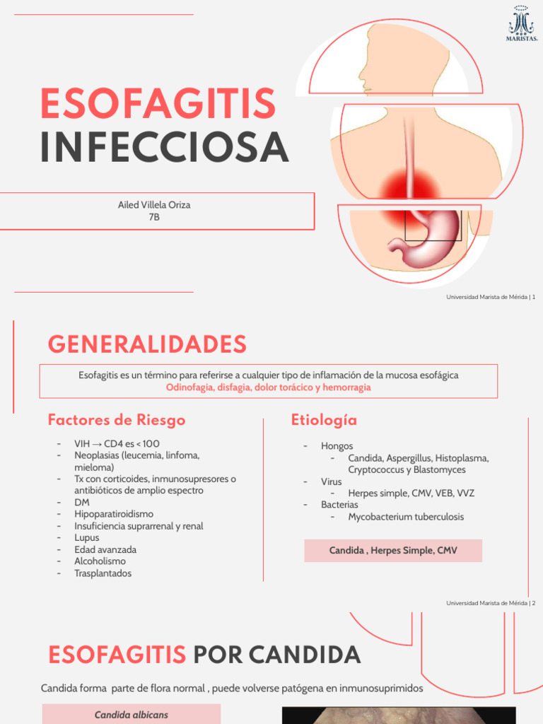 Esofagitis Infecciosa: Causas y Tratamiento | PDF | Medicina CLINICA ...
