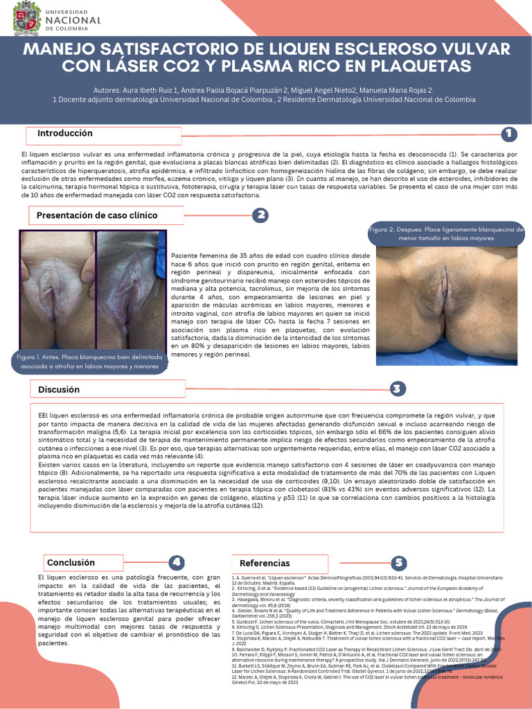 Manejo del Liquen Escleroso Vulvar | PDF | Medicina | Enfermedades y trastornos
