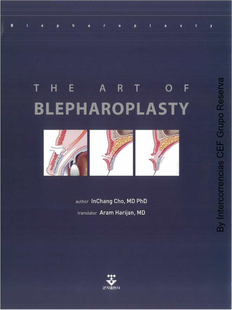 A Arte Da Blefaroplastia-1 | PDF | Cirurgia plástica | Olho