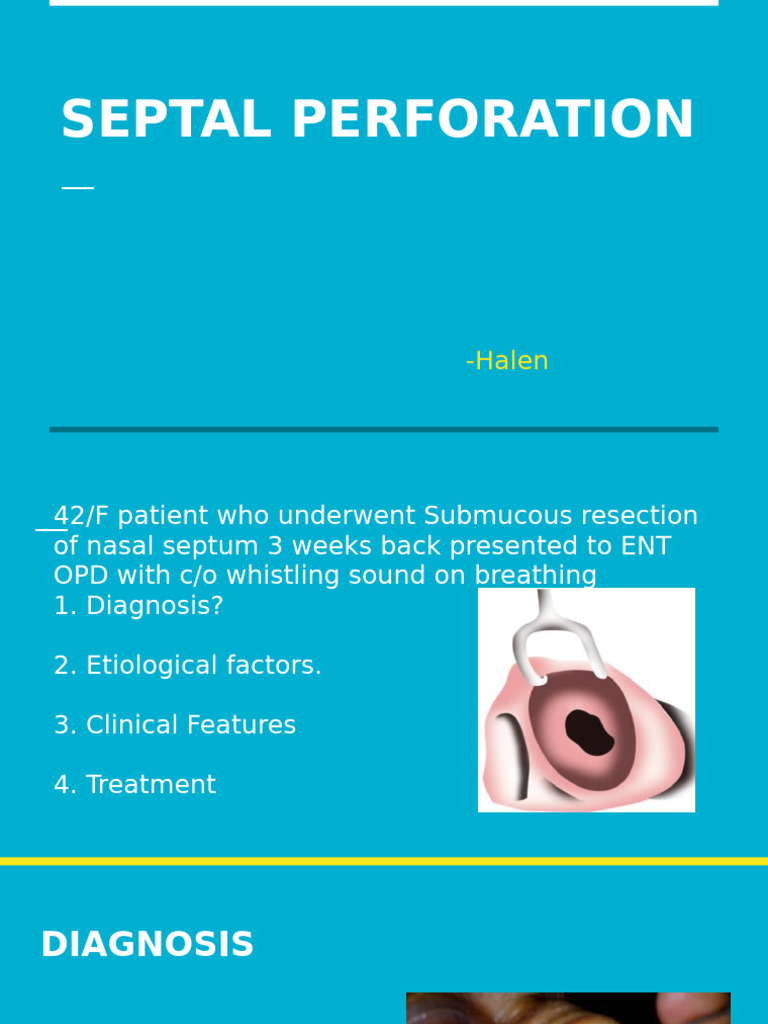 Septal Perforation: Diagnosis and Treatment | PDF