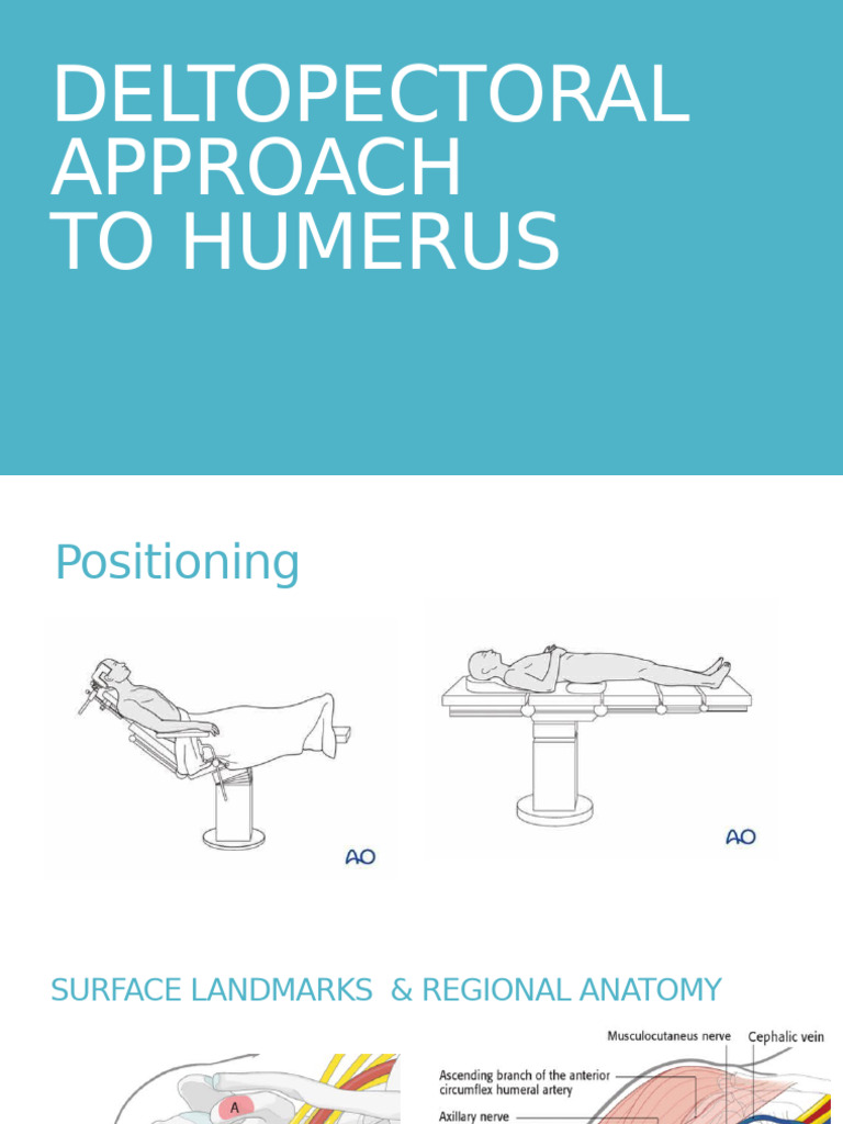 Deltopectoral Approach to Humerus | PDF