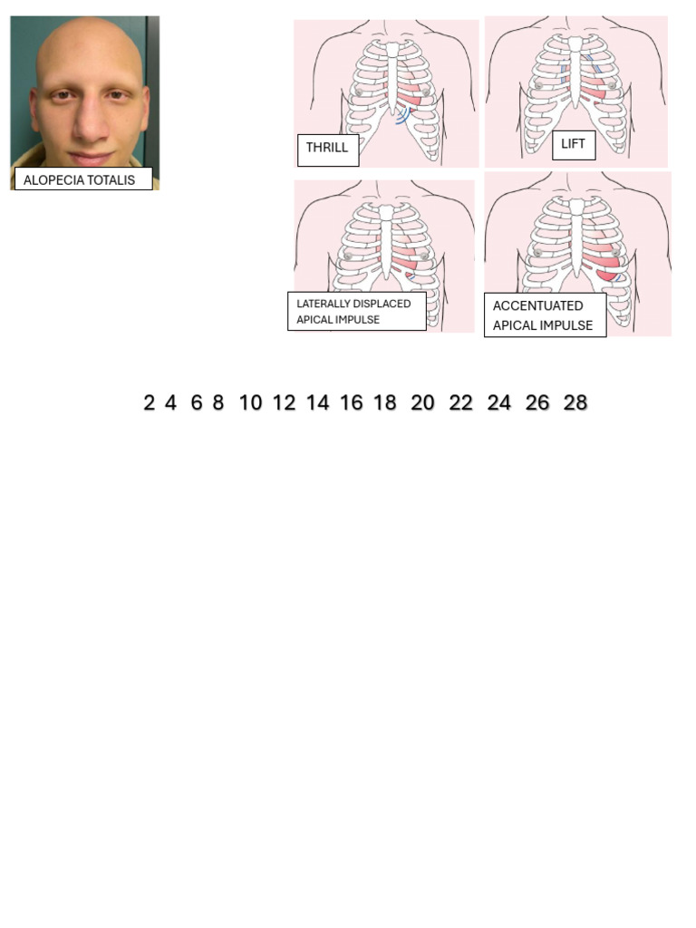 Thrill Lift: Laterally Displaced Apical Impulse | PDF