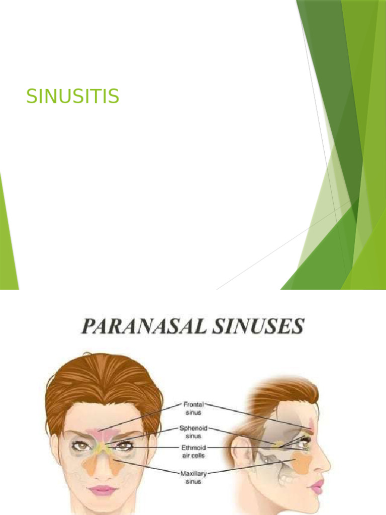 paranasal sinuses | PDF
