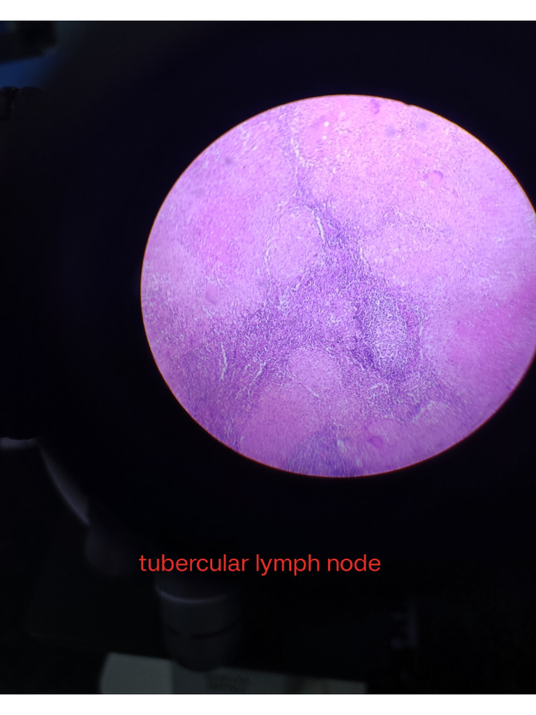 Pathology Term 2 Practical Pdf Ns Pdf