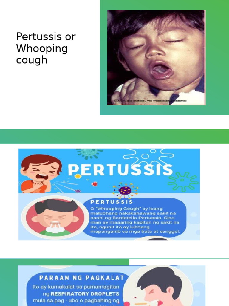 Understanding Pertussis (Whooping Cough) | PDF