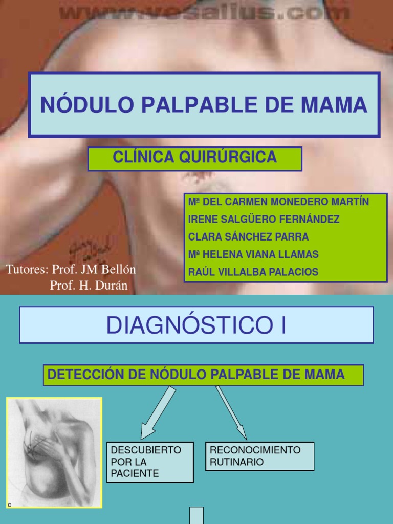 Nodulo Mama | Cáncer de mama | Biopsia