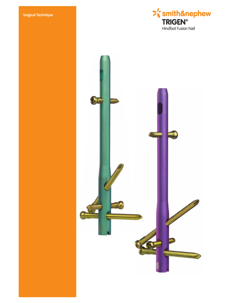 36795 V2 71181028 REVA TRIGEN Hindfoot Fusion Nail Surgical Technique ...