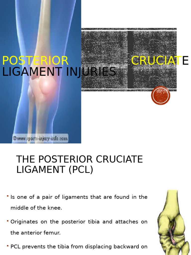 Understanding PCL Injuries and Rehabilitation | PDF | Knee | Lower Limb ...
