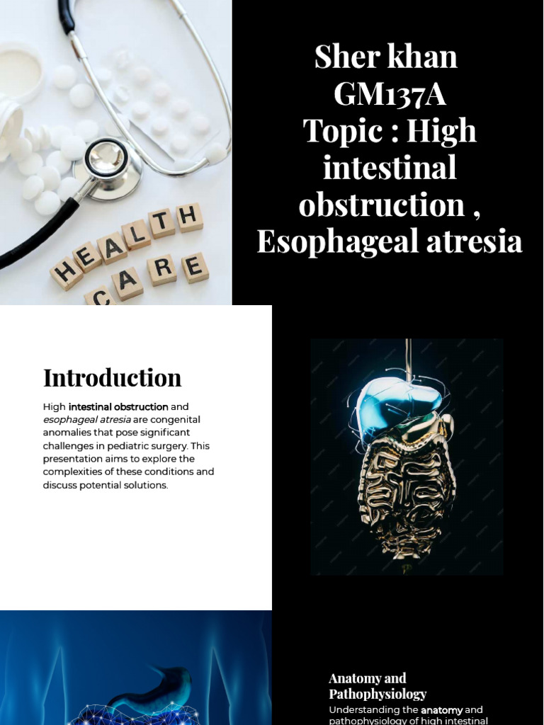 High Intestinal Obstruction. Esophageal Atresia | PDF | Surgery ...