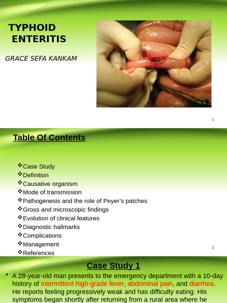 Typhoid Enteritis 1 | PDF | Salmonella | Human Diseases And Disorders