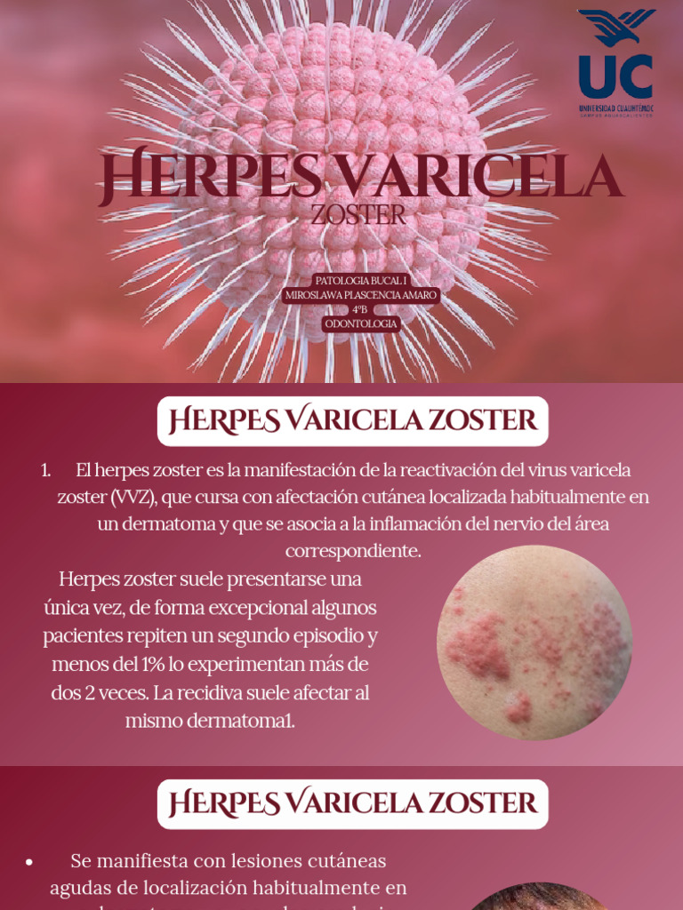 Herpes Varicela PDF | PDF | Enfermedades y trastornos | Especialidades Medicas