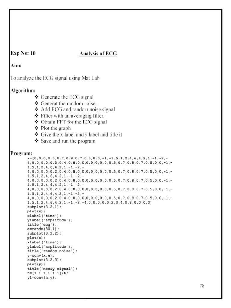 EEG and ECG Signal | PDF