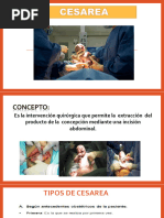 Técnicas Quirúrgicas: Hartmann y Miles | PDF | Cáncer colonrectal | Cirugía