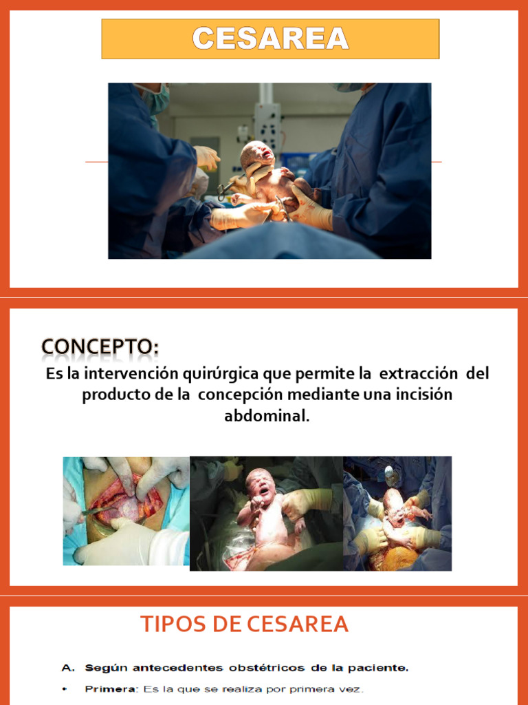 Guía Completa sobre la Cesárea | PDF | Parto | Especialidades Medicas