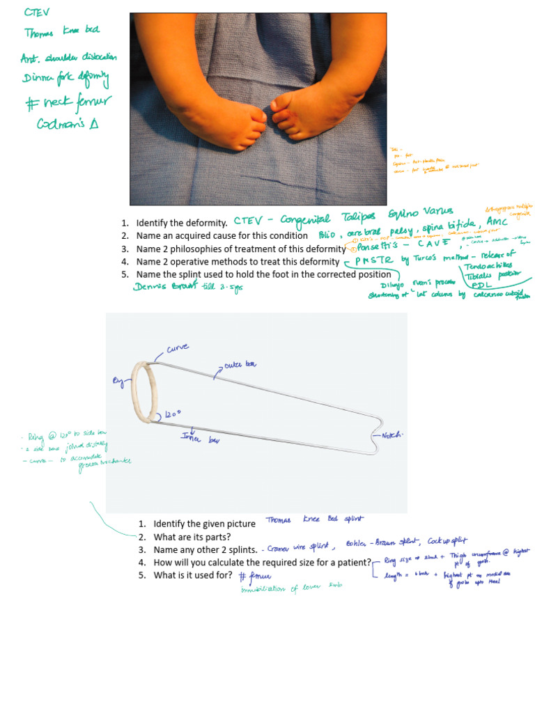 Ortho Osce | PDF | Bone | Musculoskeletal Disorders