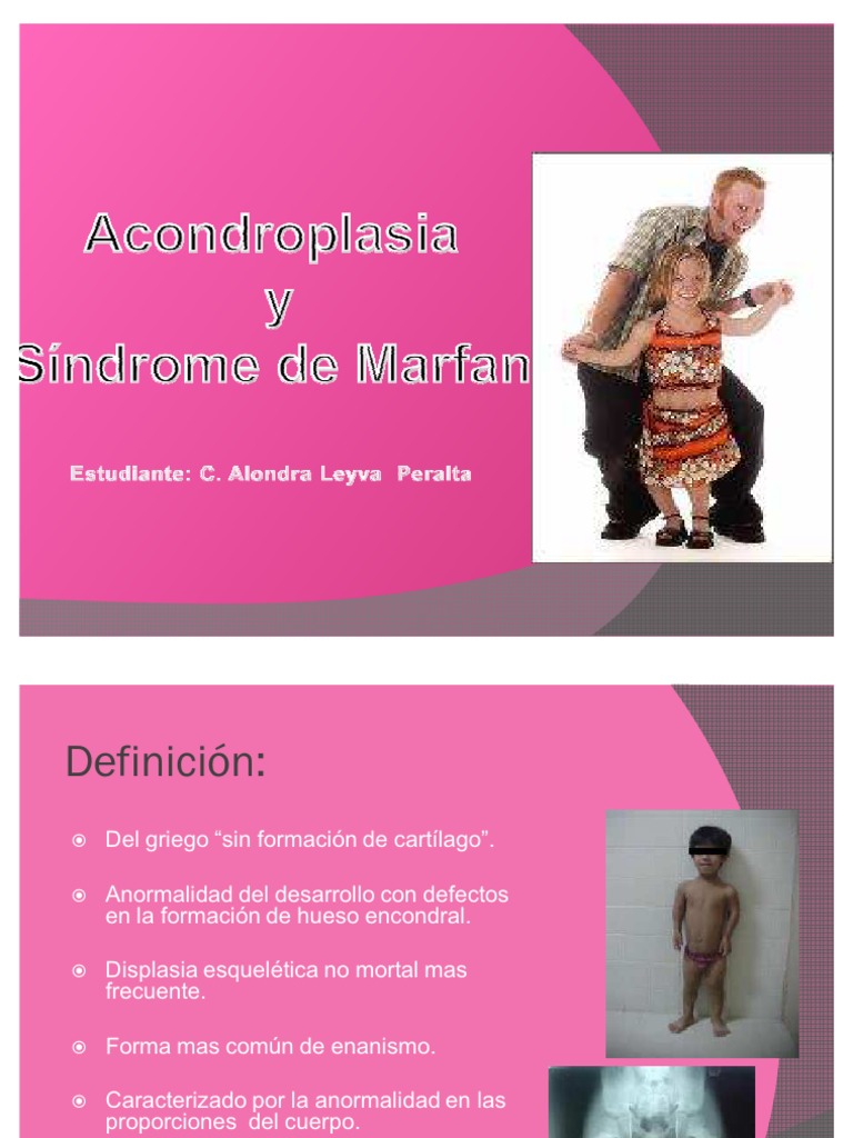 ACONDROPLASIA | PDF | Cartílago | Hueso