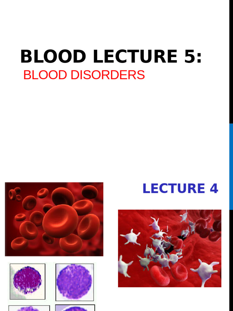 Blood Disorders: Anemia and Leukemia Overview | PDF | Anemia | Haemophilia