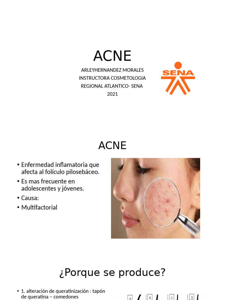 Acne | PDF