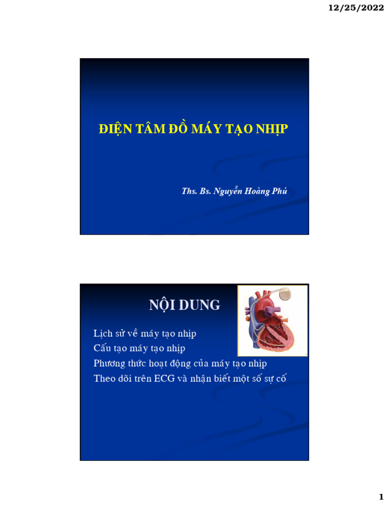 Ecg May Tao Nhip | PDF
