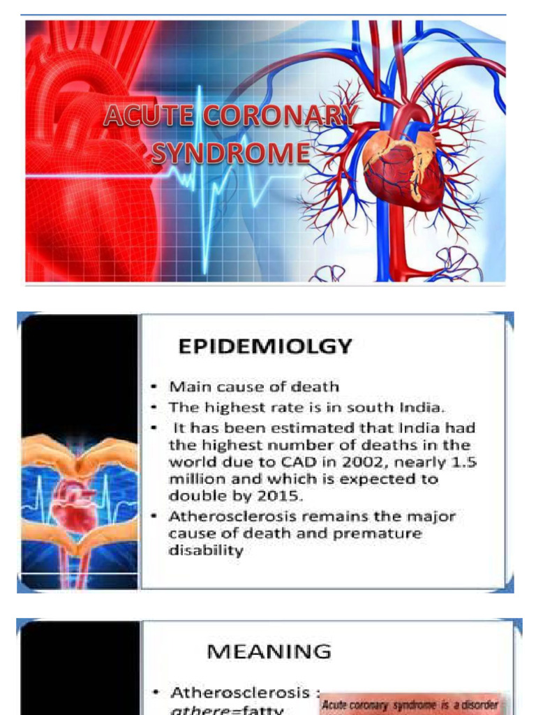 Acute Coronary Syndrome | PDF