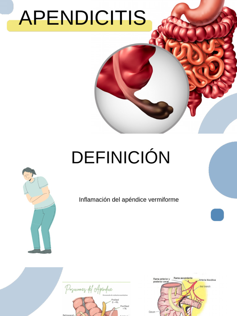 Apendicitis Aguda 1 | PDF