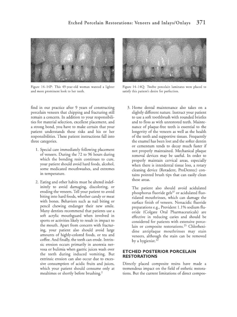 indirect restoration | PDF
