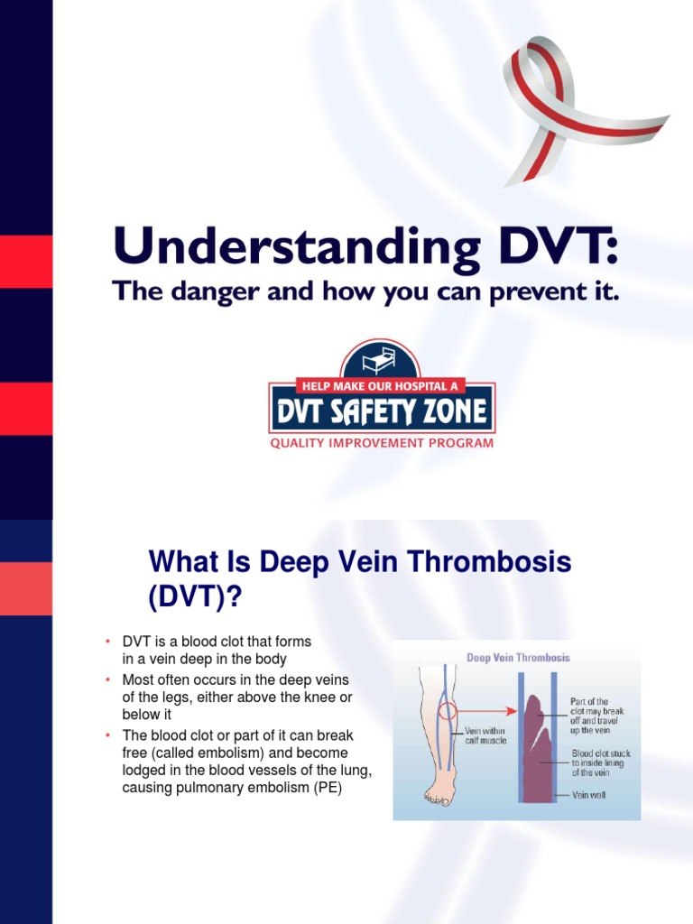 Understanding Deep Vein Thrombosis | PDF | Vein | Thrombosis