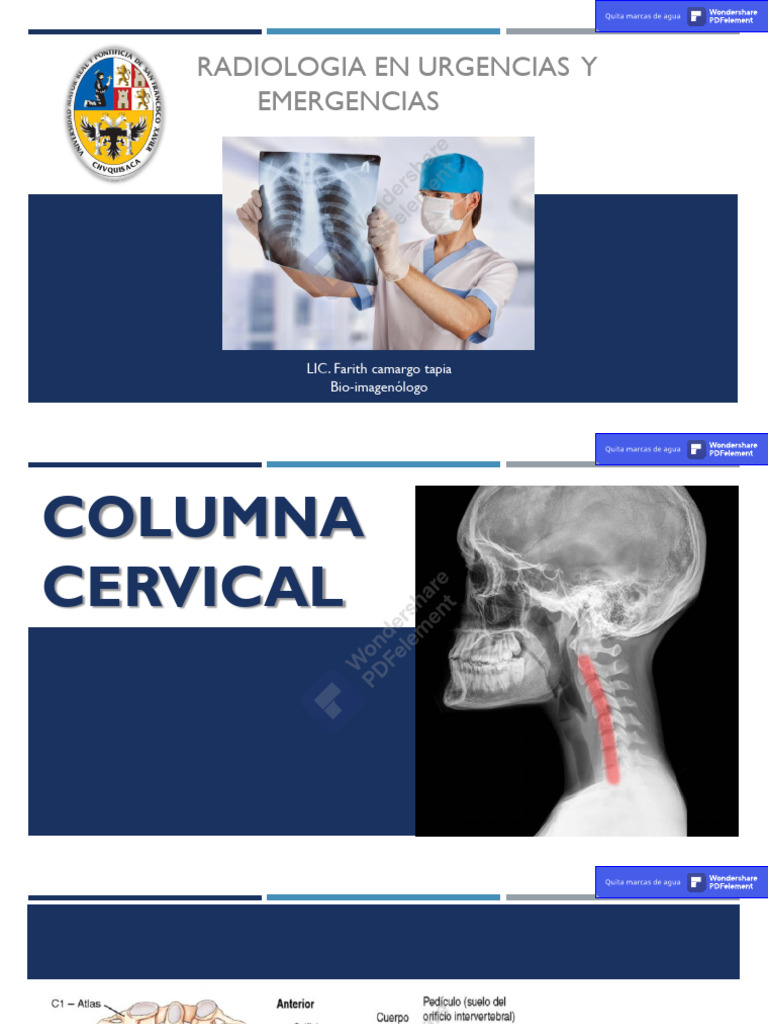 Columna Cervical | PDF | Vértebra | Sistema musculoesquelético
