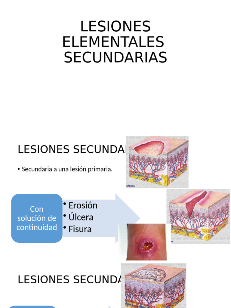 Tipos de Lesiones Secundarias en Piel | PDF