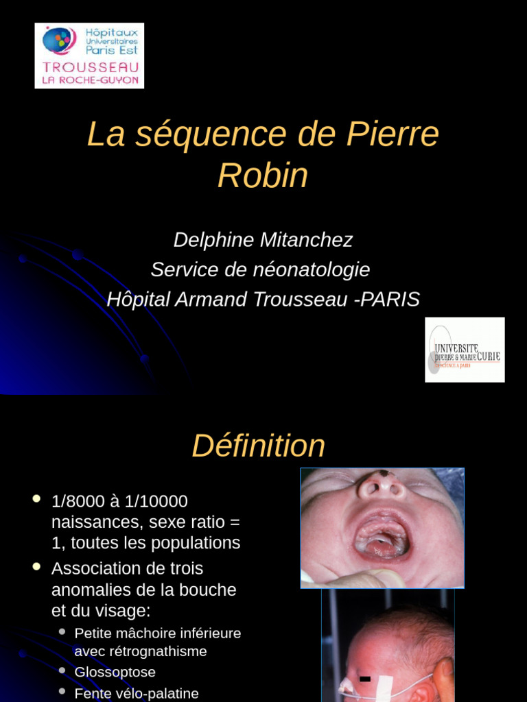 Séquence de Pierre Robin : Diagnostic et Prise en Charge | PDF ...
