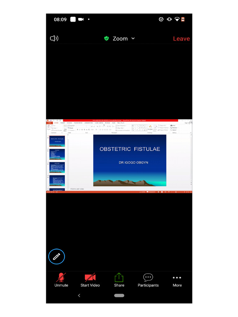 fistula -Igogo | PDF