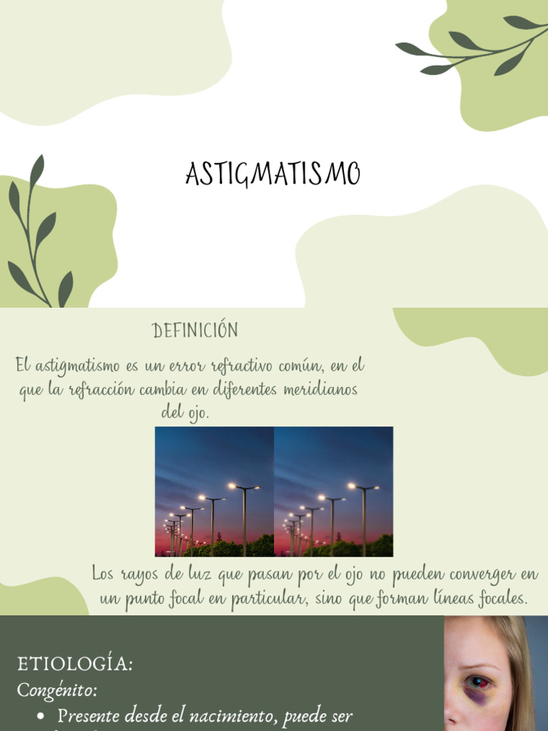 Astigmatismo: Tipos y Clasificación | PDF | Ojo humano | Glaucoma