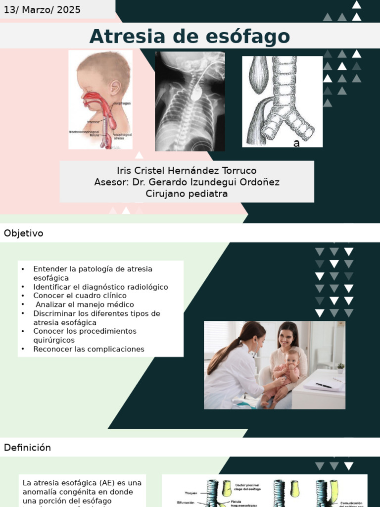 Atresia de Esófago: Diagnóstico y Tratamiento | PDF | Neumonía | Tos