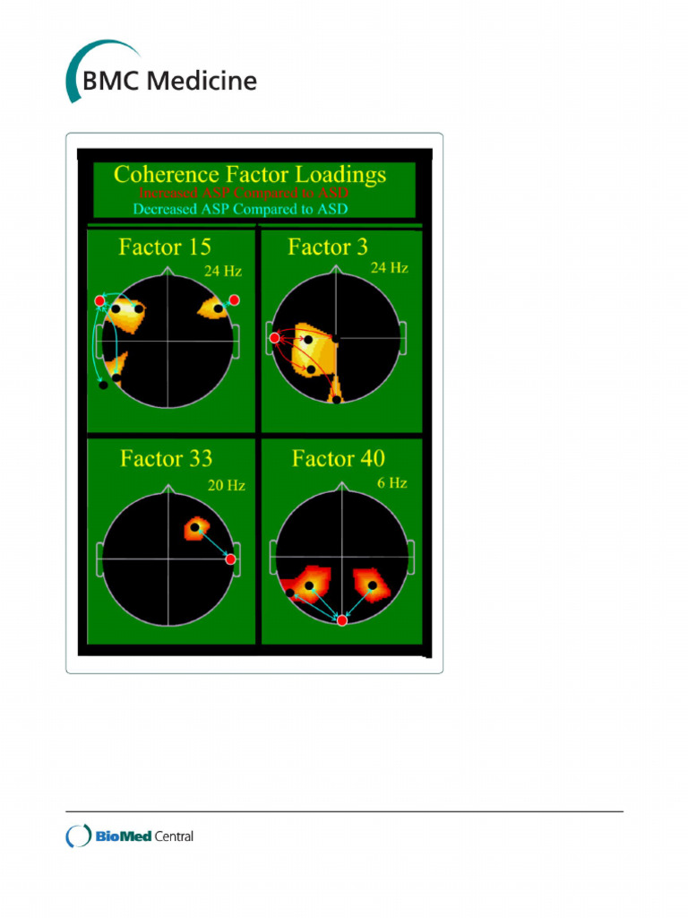 Coerência do EEG: Asperger vs Autismo | PDF | Autismo ...