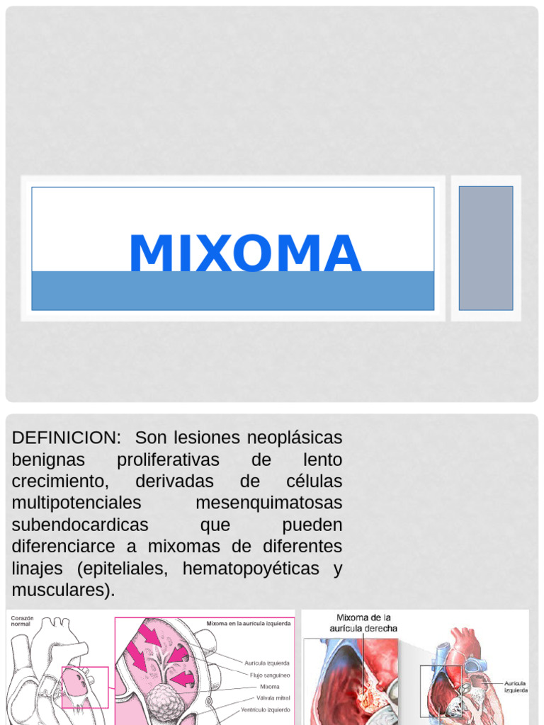Cirugía y manejo del mixoma cardíaco | PDF | Corazón | Enfermedades y ...