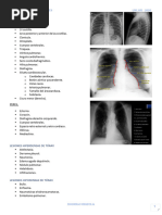 Patologías en RX | PDF | Pulmón | Tórax