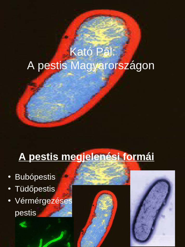 A Pestis Magyarorszagon (Kato Pal) | PDF