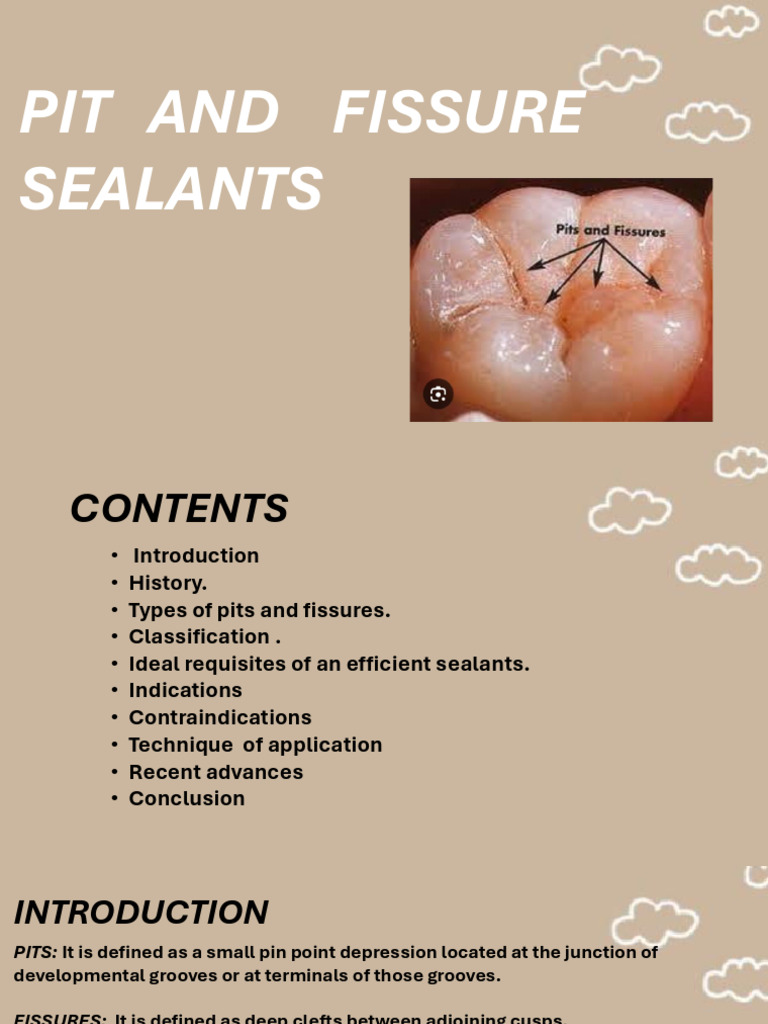 Pit and Fissure Sealants Overview | PDF | Dentistry | Materials