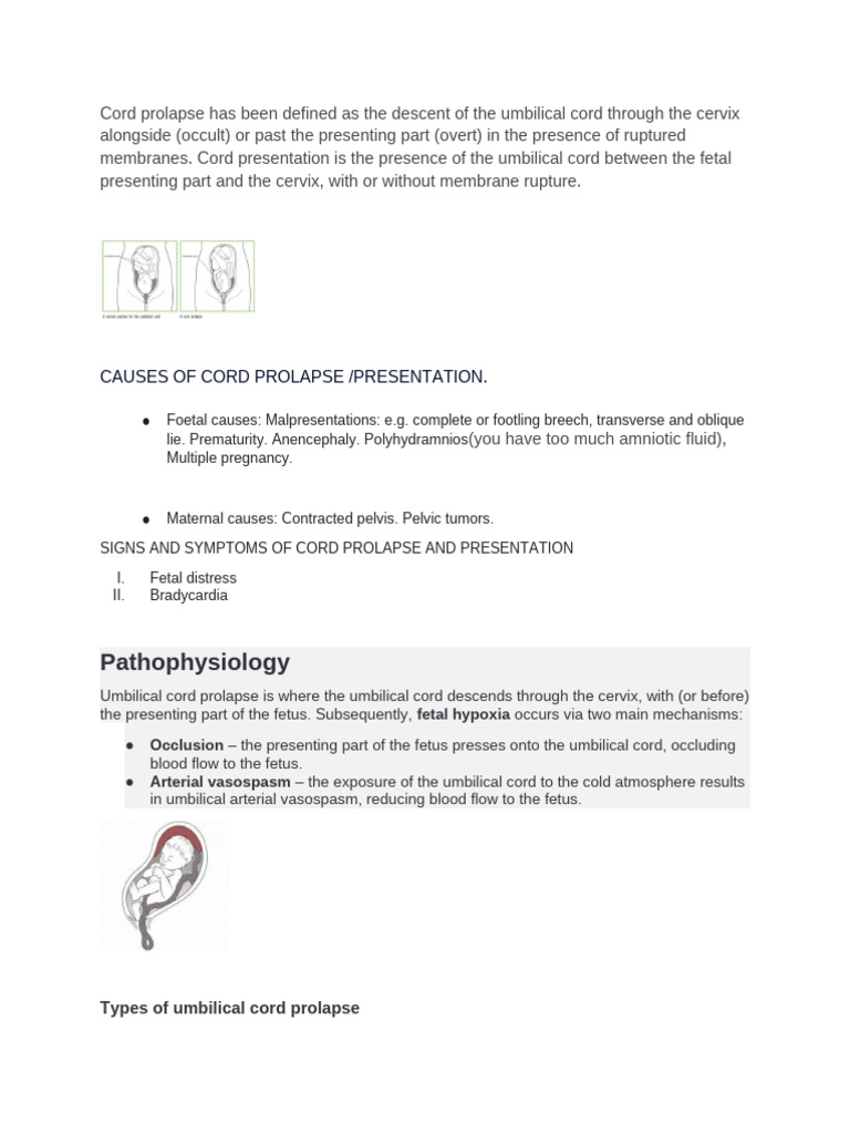Understanding Umbilical Cord Prolapse | PDF | Childbirth | Fetus