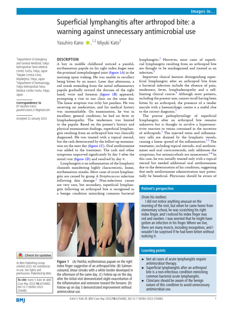 Artikel Limfangitis Superfisial Akibat Gigitan Artropoda | PDF ...