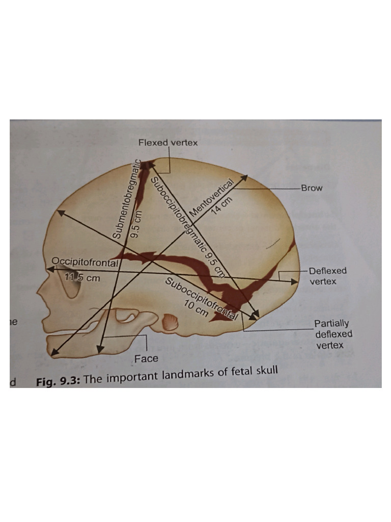 Landmark of fetal skull | PDF