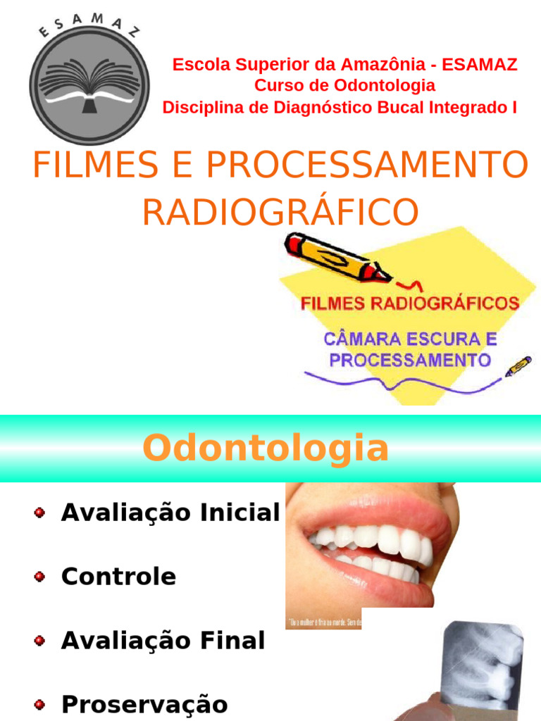 Filmes e Processamento Radiográfico | PDF | Neoplasmas | Osso