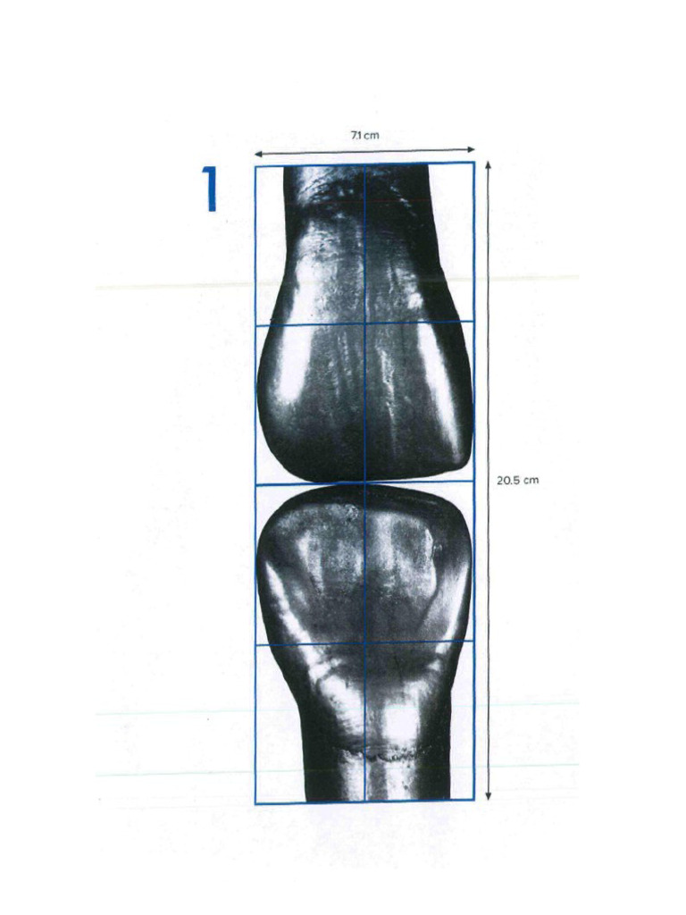 Anatomía, Prácticas Pre Encerado | PDF