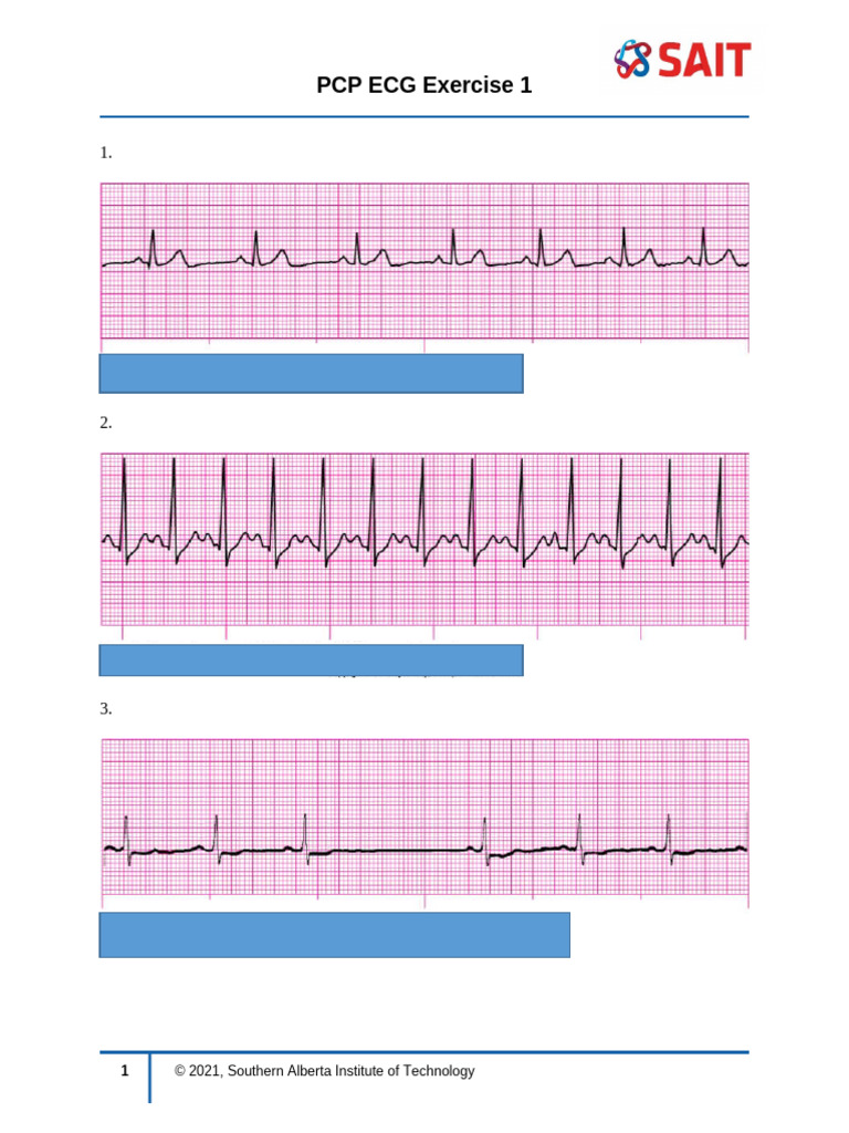 PCP ECG Exercise 1 2 | PDF