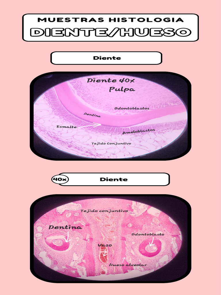 diente histo | PDF