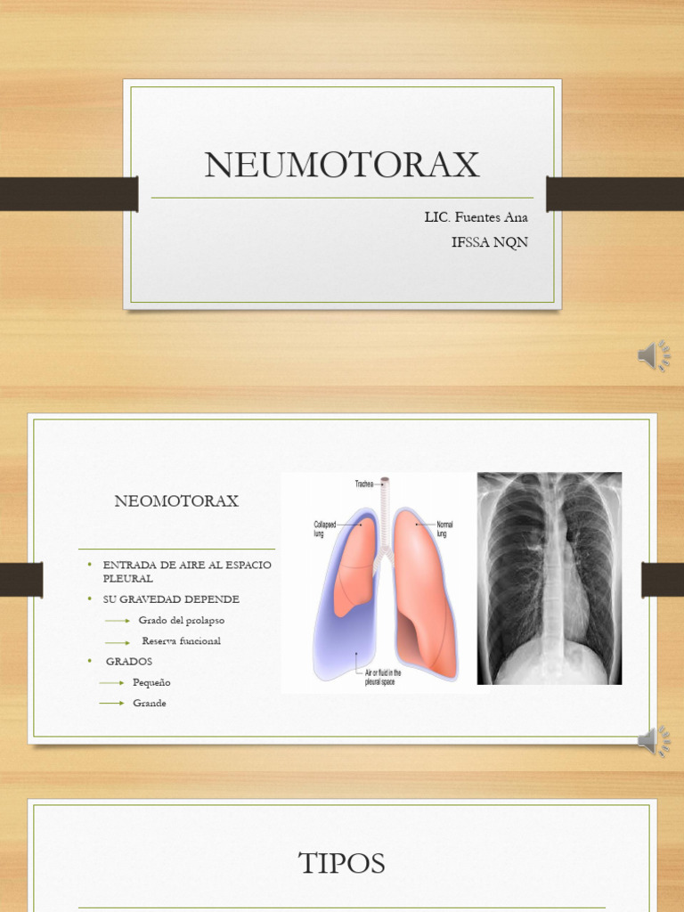 NEUMOTORAX | PDF | Especialidades Medicas | Enfermedades y trastornos