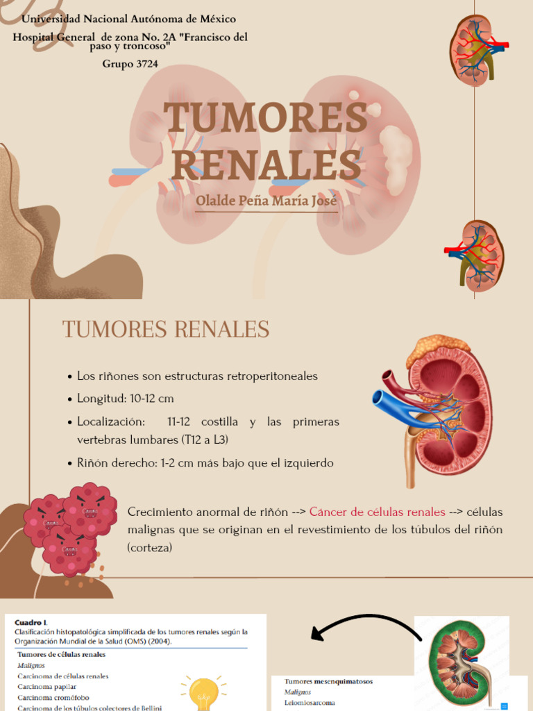 Tumores Renales: Tipos, Diagnóstico y Tratamiento | PDF | Riñón | Cáncer