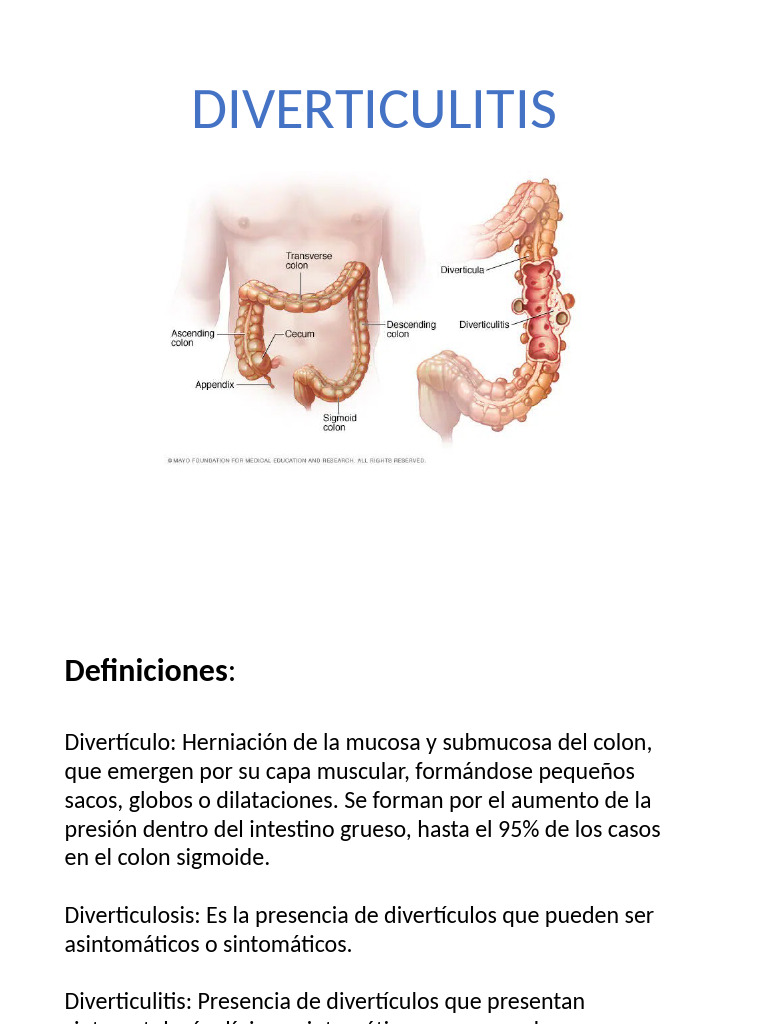 Diverticulitis | PDF
