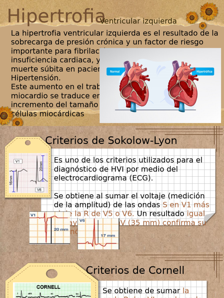 hipertrofia ventricular izquierda | PDF | Corazón | Insuficiencia cardíaca