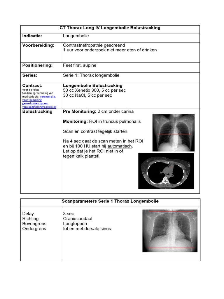 CT - Thorax Long IV Longembolie Bolustracking SEH WZ (Versie 4) | PDF